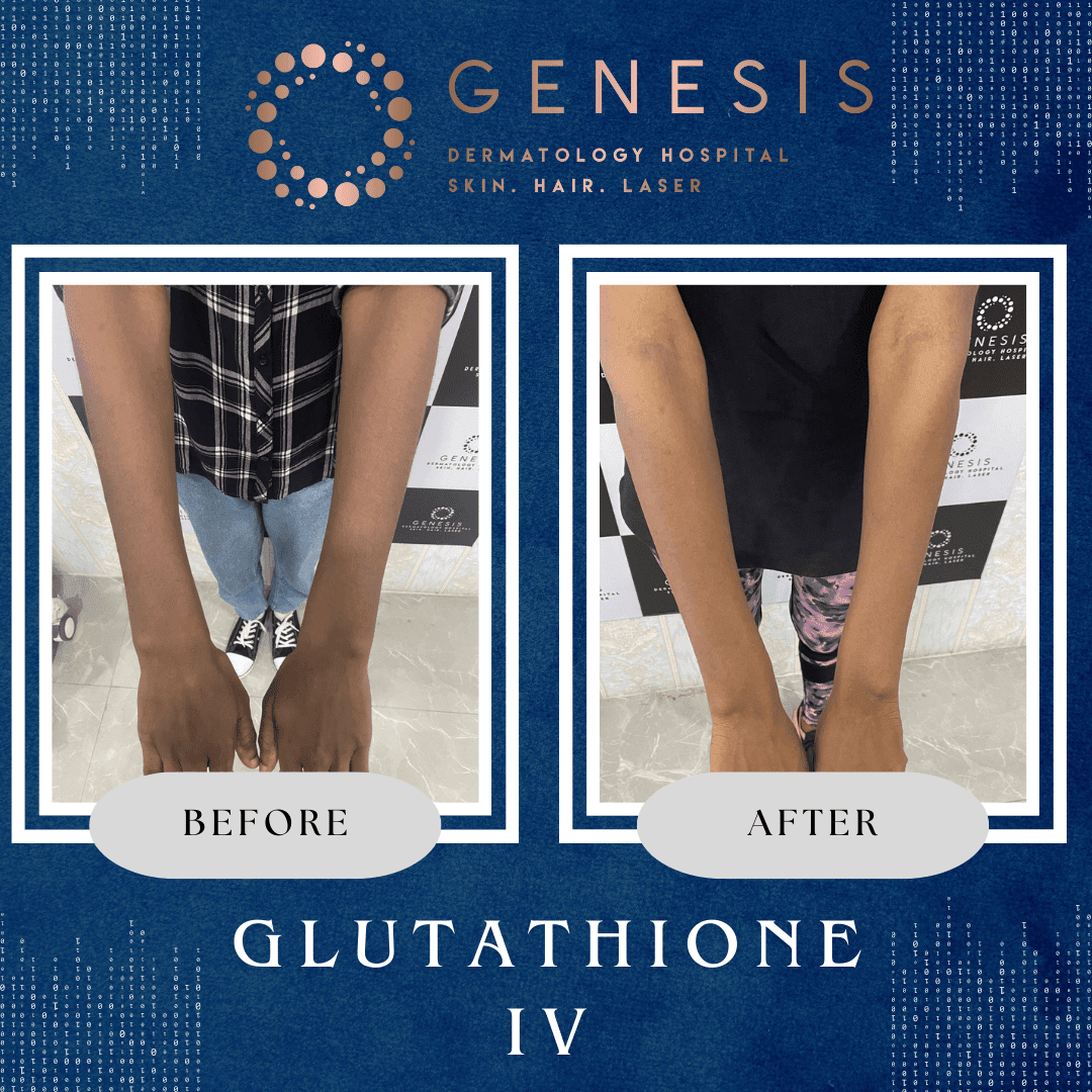 Genesis Dermatology | Skin, Hair & Laser Excellence in Chennai