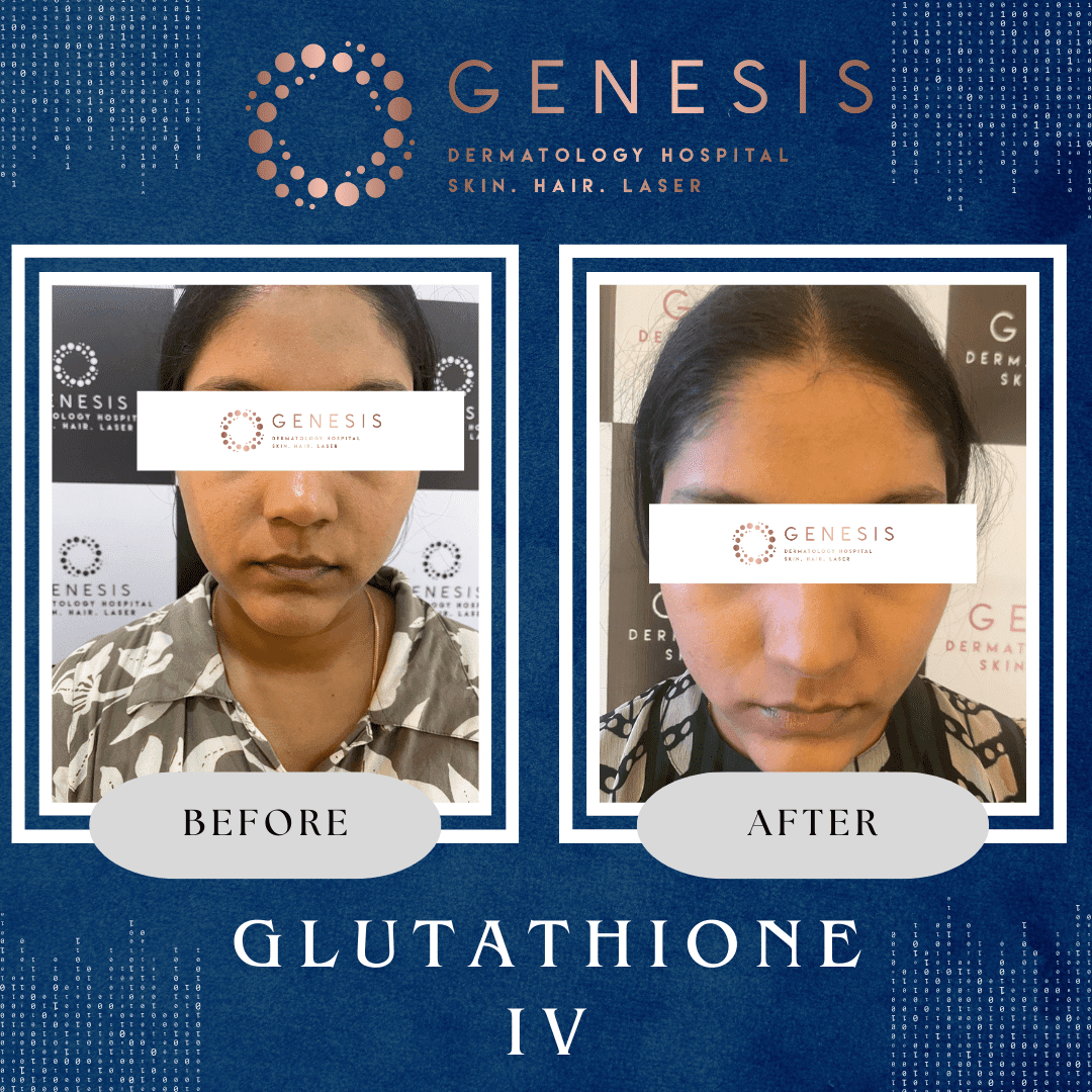 Genesis Dermatology | Skin, Hair & Laser Excellence in Chennai