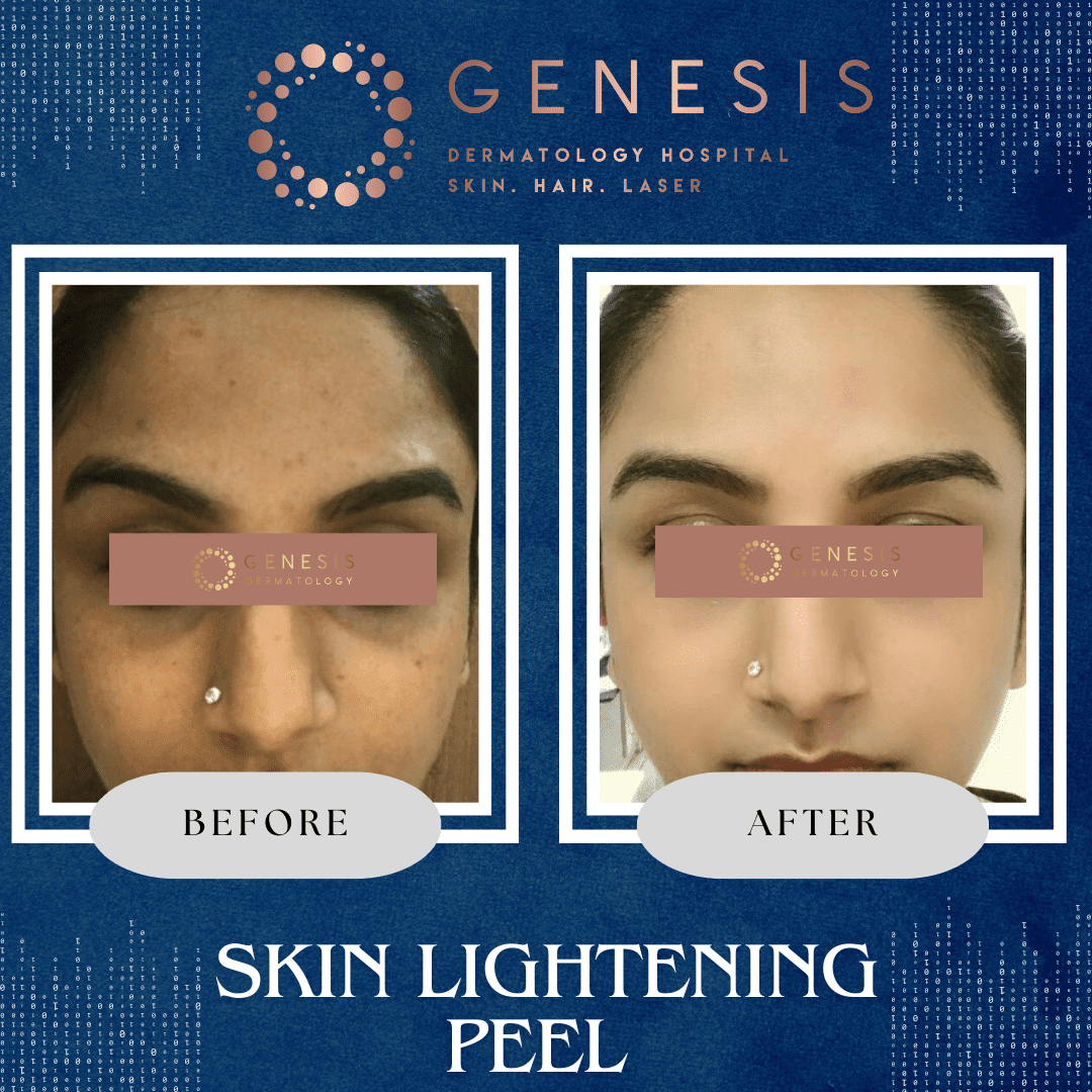 Genesis Dermatology | Skin, Hair & Laser Excellence in Chennai