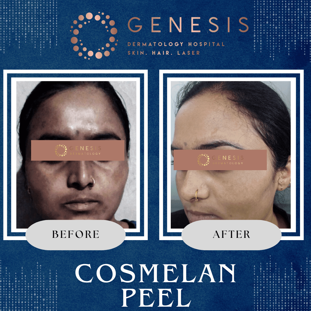 Genesis Dermatology | Skin, Hair & Laser Excellence in Chennai